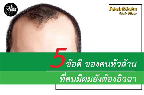 Hairmate Like สาระ 5 ข้อดี ของคนหัวล้าน ที่คนมีผมต้องอิจฉา 👍🏻 1 ไม่