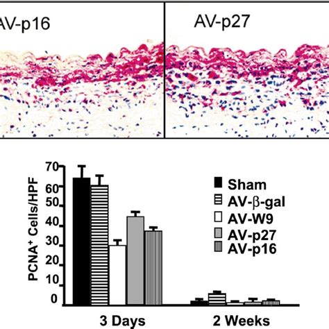 pcna gene expression top the level of pcna expression was examined