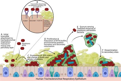 Haemophilus Influenzae Type B Symptoms