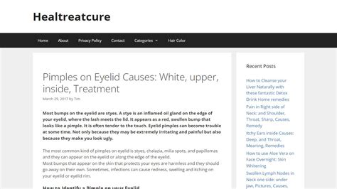 White Pimple On Eyelid Beauty Tips