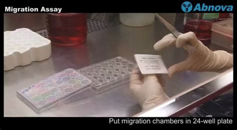 Transwell Migration Assay 细胞迁移实验操作教程哔哩哔哩bilibili