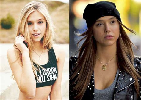 Alexis Ren Plastic Surgery Lip Injections Nose Job Butt