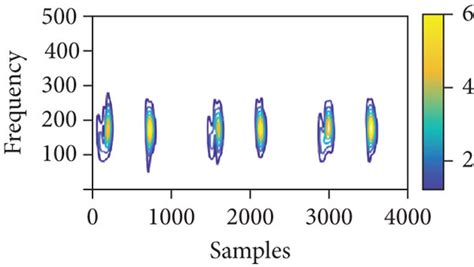 A Typical Pcg Recording Of The Normal Class B Time Frequency