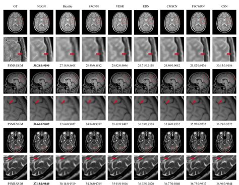 Visual Effects Under Bicubic Degradation The Maximal PSNR DB And