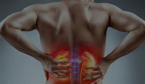 신우신염pyelonephritis 원인 증상 진단 진료과 치료 기간 염증 수치 등 알아보기