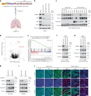 KDM6A Epigenetically Regulates Subtype Plasticity In Small Cell Lung