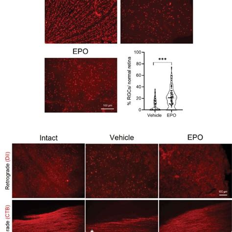 Assessment Of Epo Treatment Effect On Gene Expression Of Cytokines And