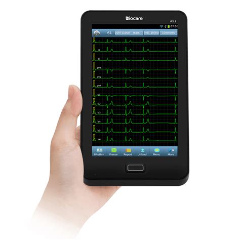 Point Of Care 12 Lead Ecgekg Machine Based On A Tablet With Auto