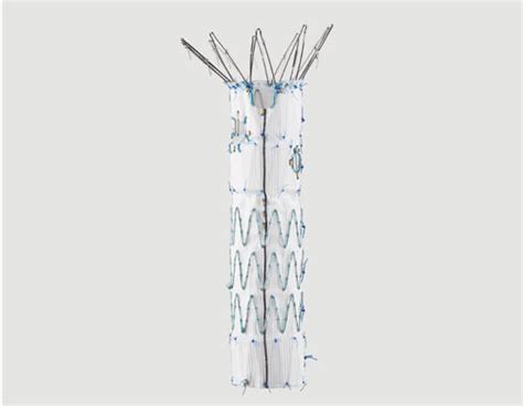 Zenith Fenestrated Aaa Endovacular Graft Cook Medical