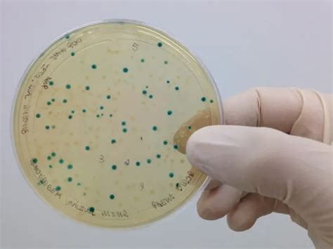 Identificar Patógenos Gentros