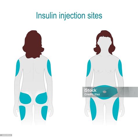Printable Chart For Insulin Injection Sites Free Printable Charts