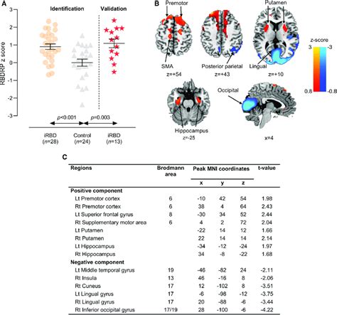 Rapid Eye Movement Rem Sleep Behavior Disorder Related Metabolic