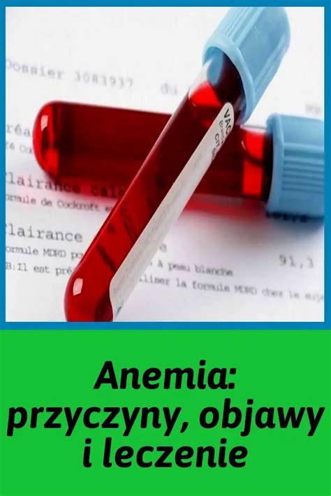 Anemia Przyczyny Objawy I Leczenie