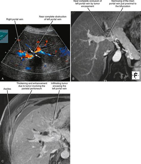 Gallbladder And Bile Ducts Radiology Key