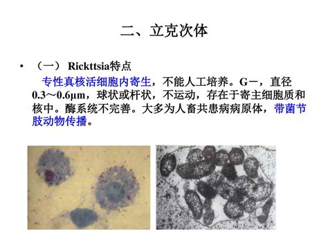 第二节 放线菌 放线菌（actinomycetes）是一类呈分枝状生长、主要以孢子繁殖的，多为g的单细胞原核生物。 Ppt Download
