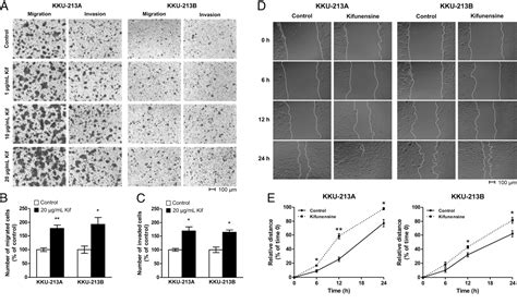 Figure 2 From Metastasis Of Cholangiocarcinoma Is Promoted By Extended High Mannose Glycans
