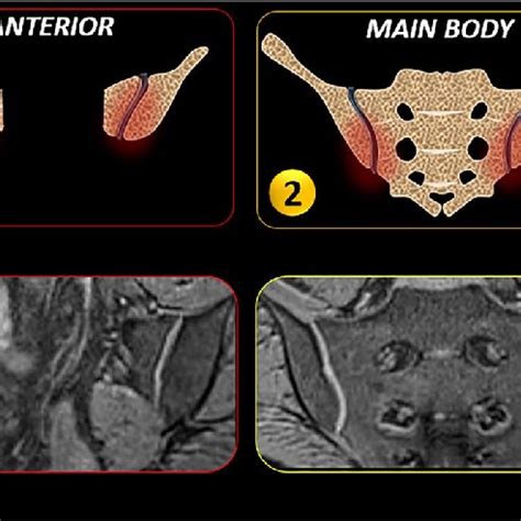 Schematic Figure Summarizing A Good Approach To Evaluate The Sacroiliac