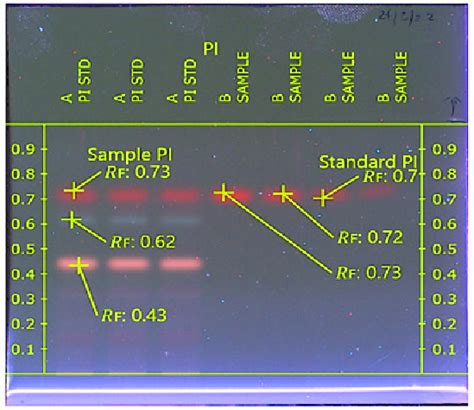 Chromatogram Obtained From Separation Of Plant Extract And Visualized