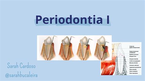 Resumo De Periodontia I Sarah Cardoso Hotmart
