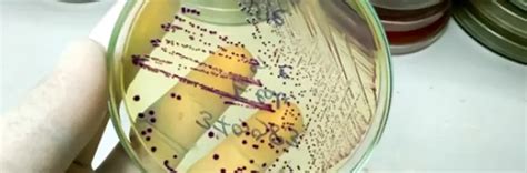 Essential Water Testing Total Coliform And E Coli Pits Environmental Services