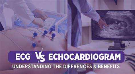 Accord Superspeciality Hospital — Ecg Vs Echocardiogram
