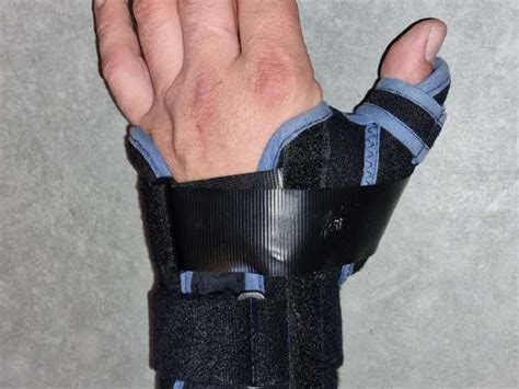 Pirsto Itvaras Skelbimai Skelbiult