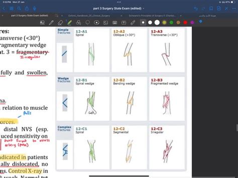 19b Diaphyseal Fractures Of Long Bones Flashcards Quizlet