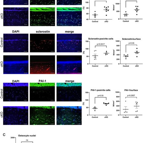 Sclerostin FGF23 And PAI 1 Protein Expression Is Reduced In The