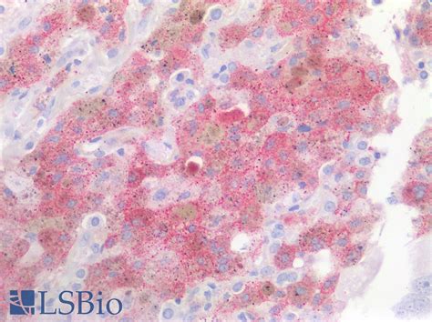 Pathplus™ Egfr Polyclonal Antibody Rabbit Anti Human Ihc Lsbio