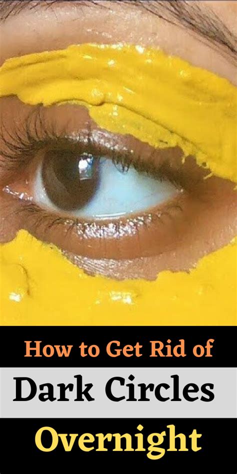 How To Permanently Get Rid Of Dark Circles — 15 Dark Circles Home