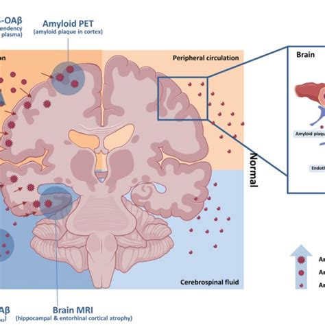 Figure E Central And Peripheral Amyloid β And Biomarkers Central And Download Scientific