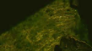 Hypertonic Vs Hypotonic Understanding The Key Differences And Their