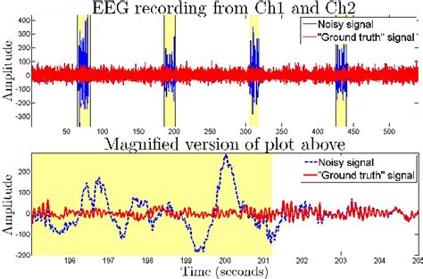 An Example Recording Of EEG Data Two Channels Are Recorded Which Are Download Scientific