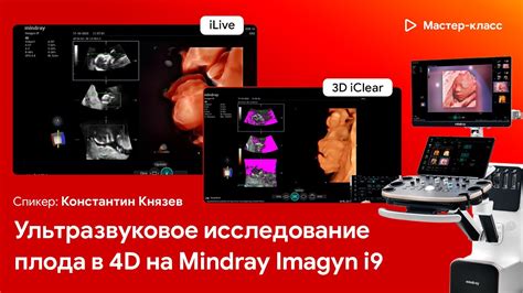 УЗИ плода в 4d на Mindray Imagyn I9 Мастер класс для врачей Youtube