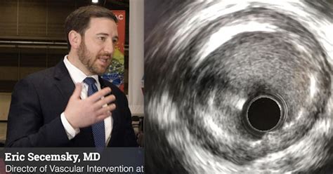 Nipro Medical Corporation On Linkedin Intravascular Imaging Guided Pci Boosts Outcomes But