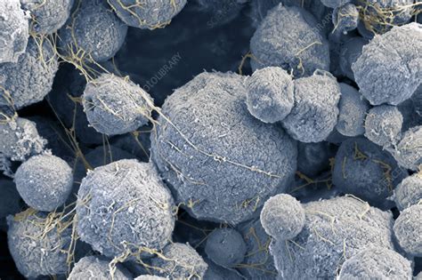 Methanosarcina Archaea Sem Stock Image B244 0040 Science Photo Library