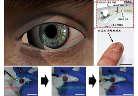 S Korean Researchers Develop Contact Lenses That Diagnose Diabetes