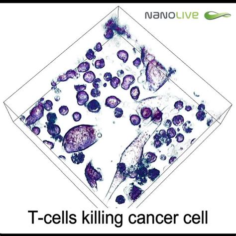 John Catanzaro On Linkedin Tcells Cancer