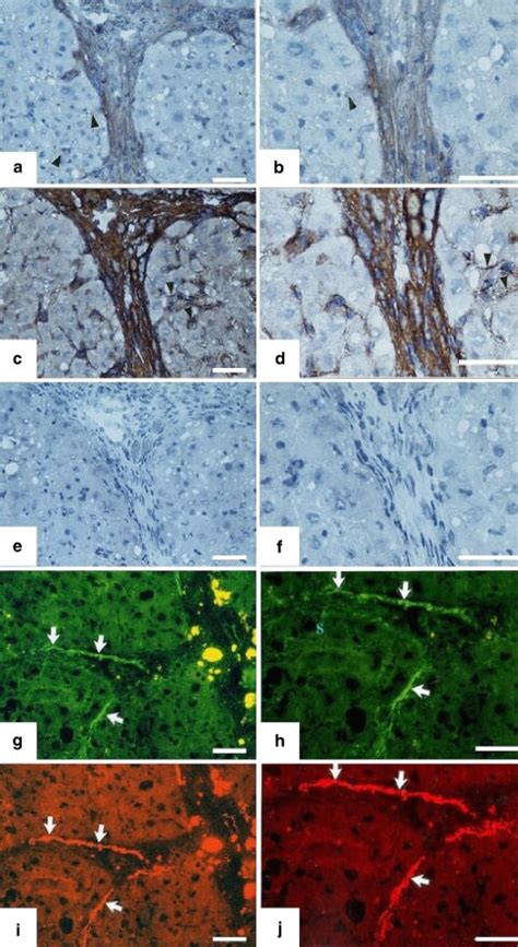 Localization Of Ecm Proteins By Peroxidase A F And Fluorescent G J Download Scientific