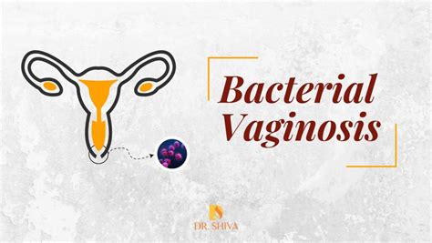 Bacterial Vaginosis Vaginitis Infection Treatments Bv Infection