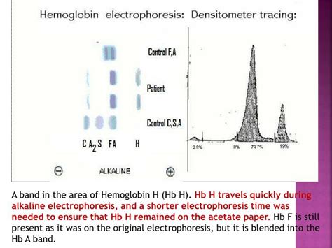 Ppt Hemoglobin Electrophoresis Powerpoint Presentation Id2372418