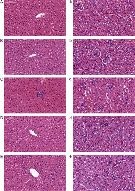 The Photomicrographs Of Hepatic And Renal Tissues Of Mice He Staining