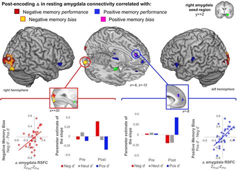 Post Encoding Enhancement Of Right Amygdala Connectivity And Download Scientific Diagram