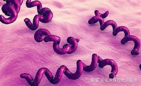 这种方式会不会传染梅毒呀 知乎