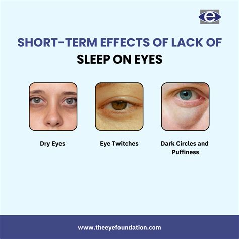 Can A Lack Of Sleep Affect Eye Health