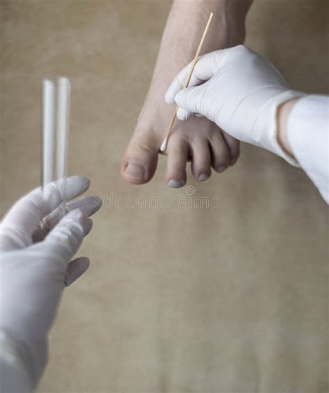 Dermatologist Using A Cotton Swab And Test Tube To Take A Swab Sample From A Patient S Leg