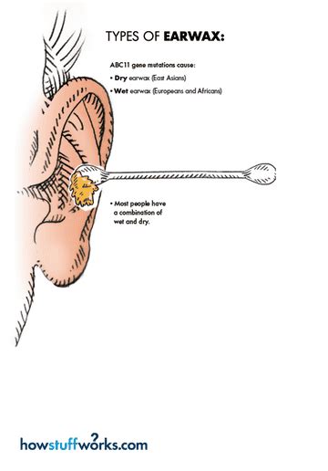 Why Do We Have Earwax