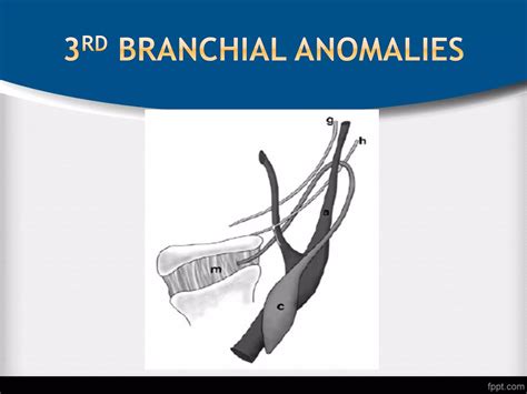 Branchial Anomalies Pptx
