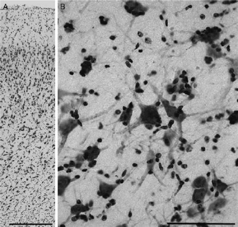 A Low Power Photomicrograph Of A 50 ␮ M Section Of The Cerebral