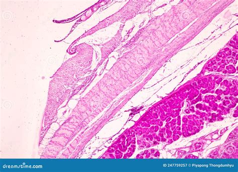 Small Intestine Duodenum And Vermiform Appendix Human Under The Microscope Stock Image Image